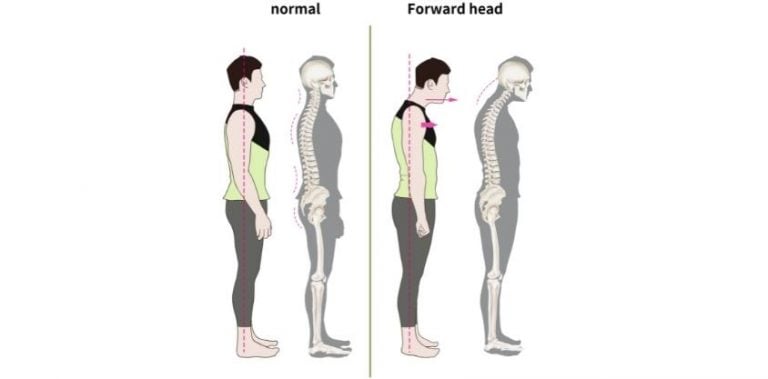 7 Useful Stretches for Shoulder Pain to Unwind Deep Tension and Restore ...