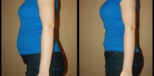 How to Lose 10 Pounds Fast: 7 Easy Tips You Wish You Knew Sooner