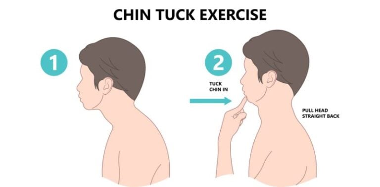 How To Get Rid of That Dowager’s Hump at the Base of Your Neck: 9 Easy ...