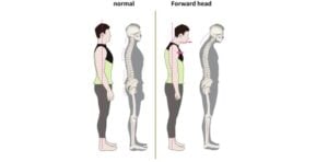 Combat Rounded Shoulders and Sit Straighter With These Simple Stretches