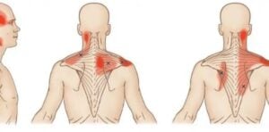 3 Gentle ‘Muscle-Release Movements’ To Relieve Upper Back Pain and Ease ...